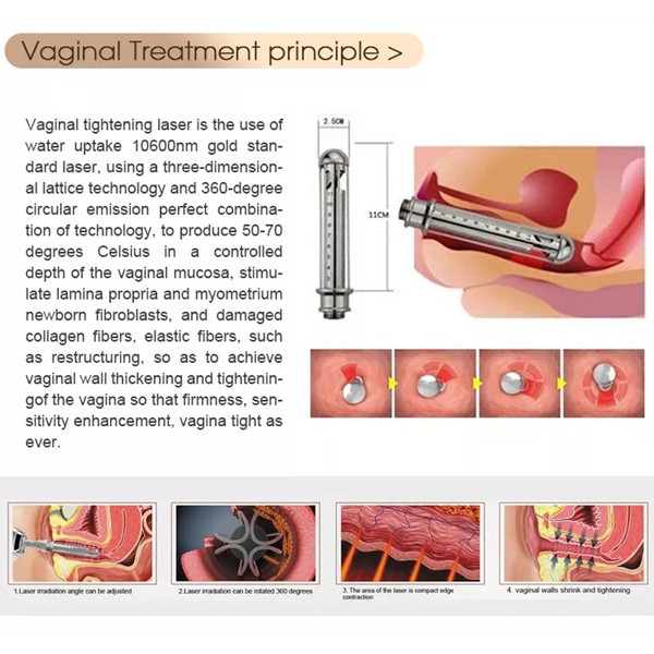 Lasertell Portable Co2 Fractional Laser Machine Vaginal Treatment Rejuvenation 1
